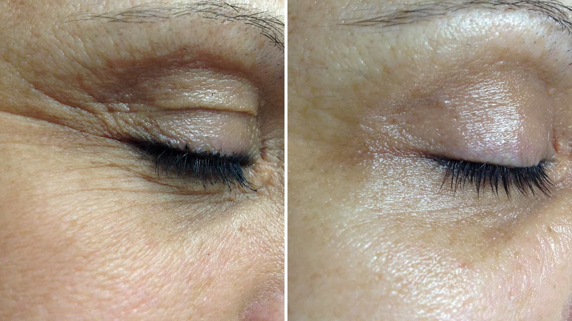 Geneo Glo2 Facial – Village Skin & Scalp Studio